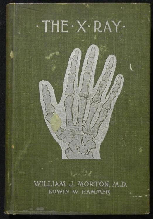 The X Ray William J Morton Antique 1E Medical Book 1896 - Dec 05, 2012 ...