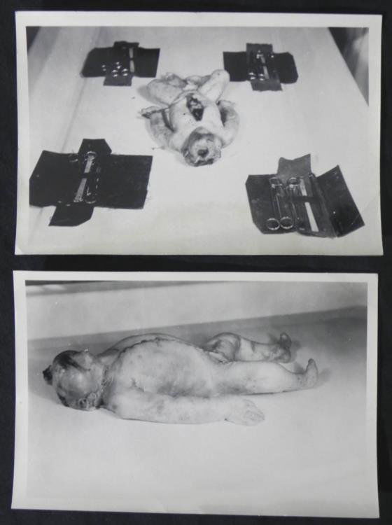 Dr. Jozef Mengele Experiment Photos Auschwitz Graphic
