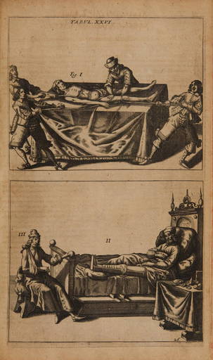 Scultetus, Johannes. 1595 1645. Cheiroplotheke, Seu Armamentarium ...