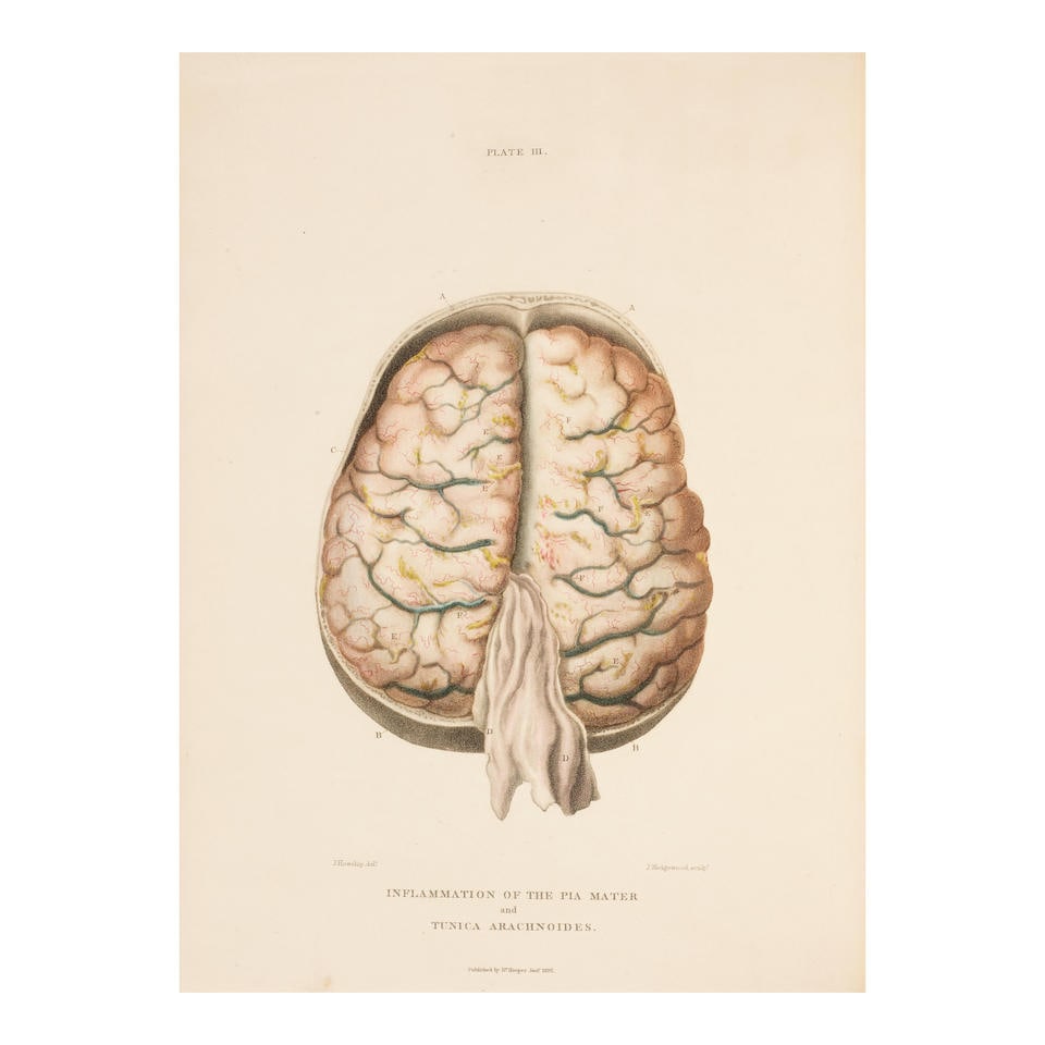 Hooper, Robert. 1773-1825. The Morbid Anatomy Of The Human Brain ...