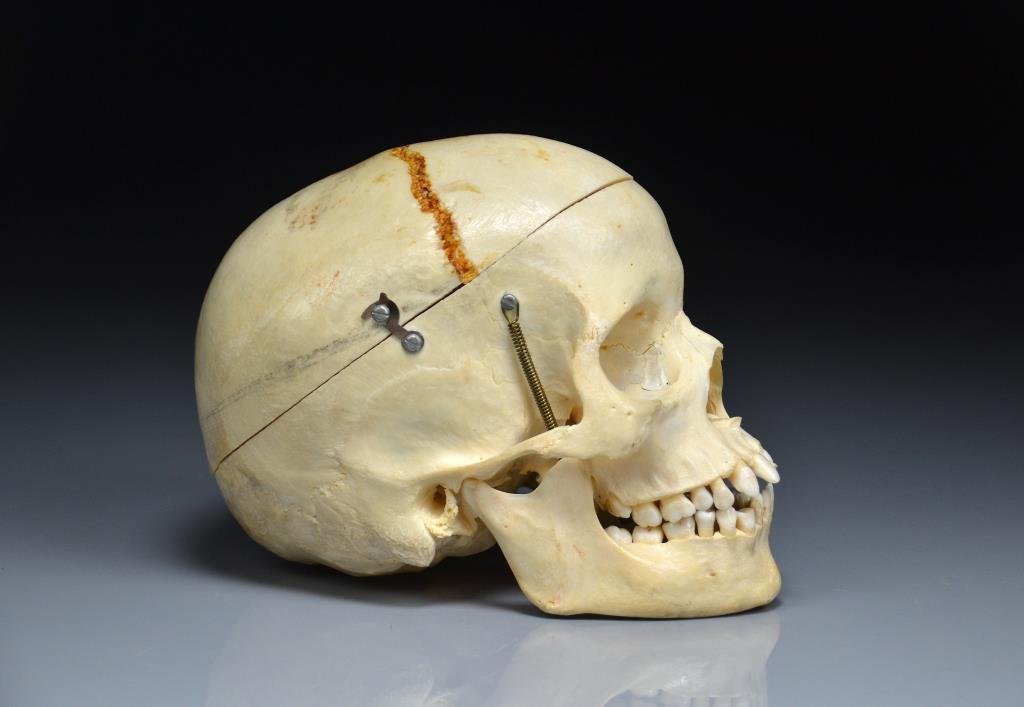 Presentation Human Skull Specimen on Stand. Medical Tea - Dec 10, 2020 ...