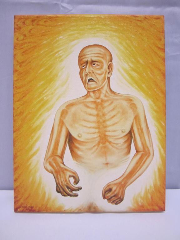 15: Copy of Kevorkian Painting "Fever"