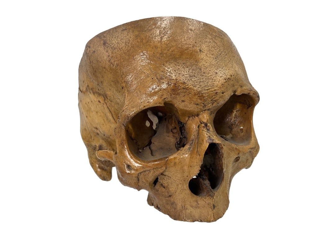 Antique Scientific Preserved Human Skull Auction