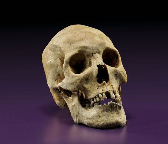 ANTIQUE HUMAN SKULL - May 04, 2013 | I.M. Chait Gallery/Auctioneers in CA