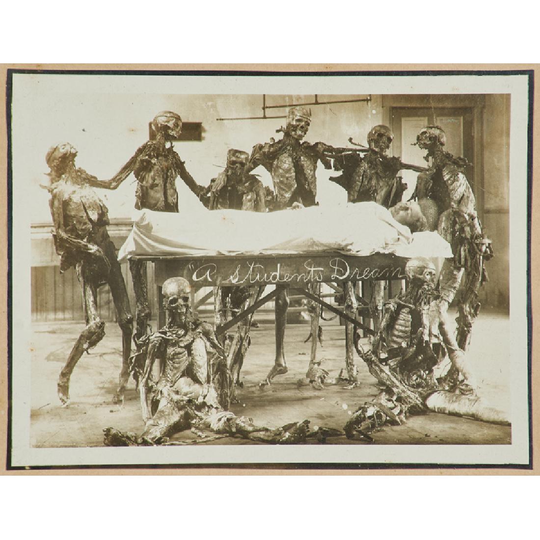 RARE AND UNUSUAL CADAVER PHOTOGRAPH