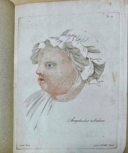 Robert Willan Skin Diseases And Their Treatment, Germany, 1799
