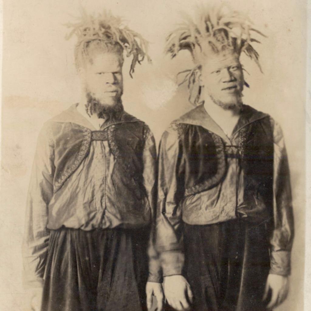 C.1920 Black Albino African American Circus Sideshow