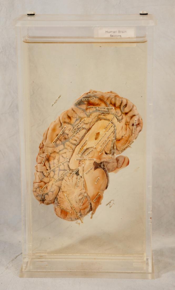 Real Human Brain Slice Professionally Prepared Fully