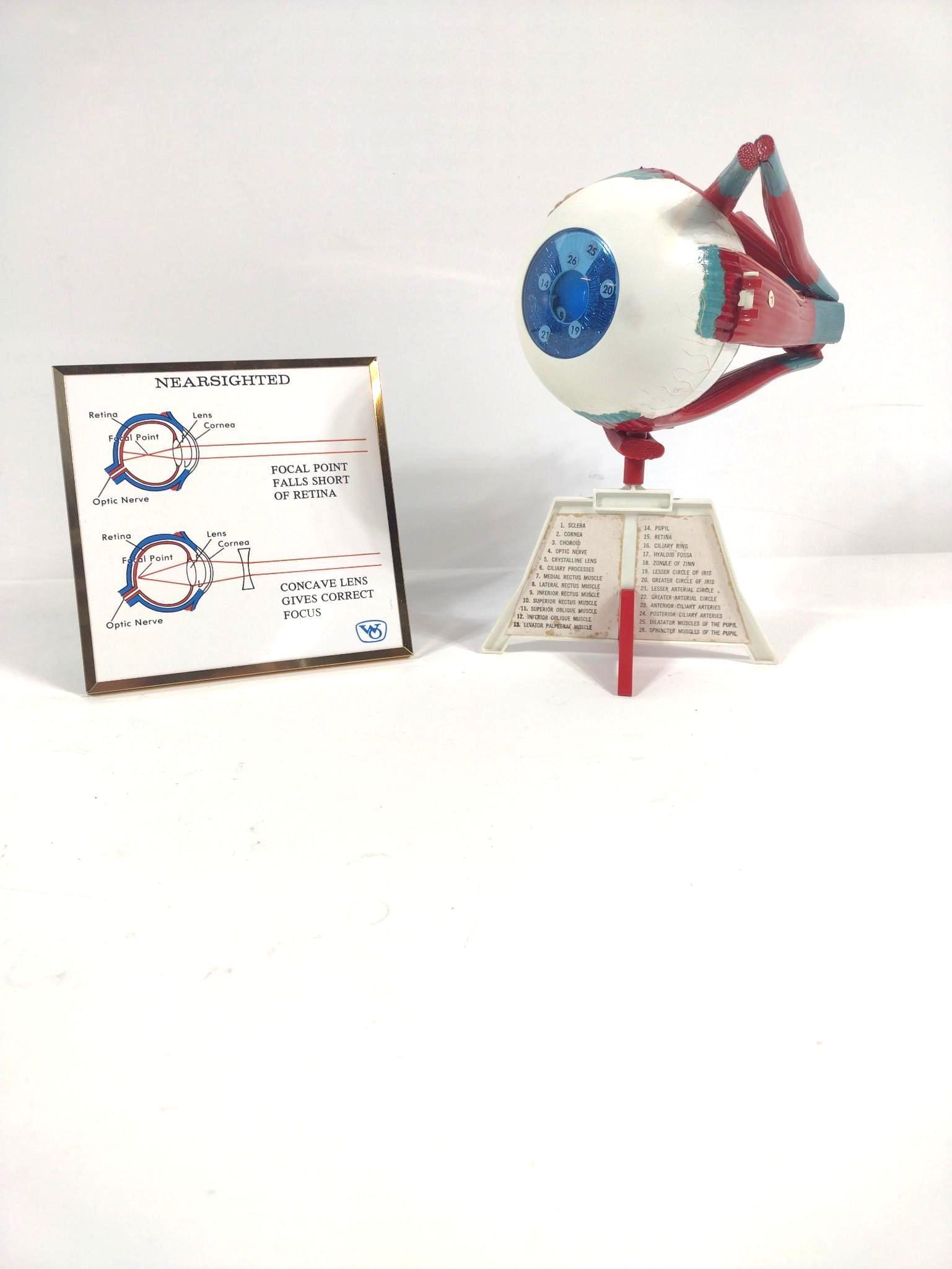 Eye Ball Model And Nearsighted Diagram