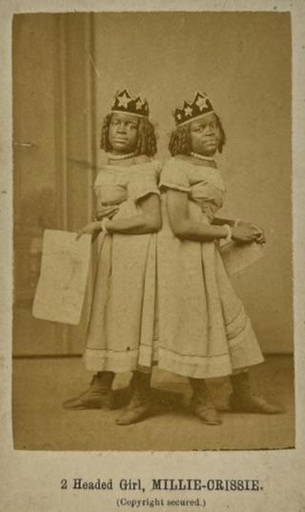 MILLIE-CRISSIE - TWO HEADED LADY (#0143) on Aug 06, 2022 | Freedom ...