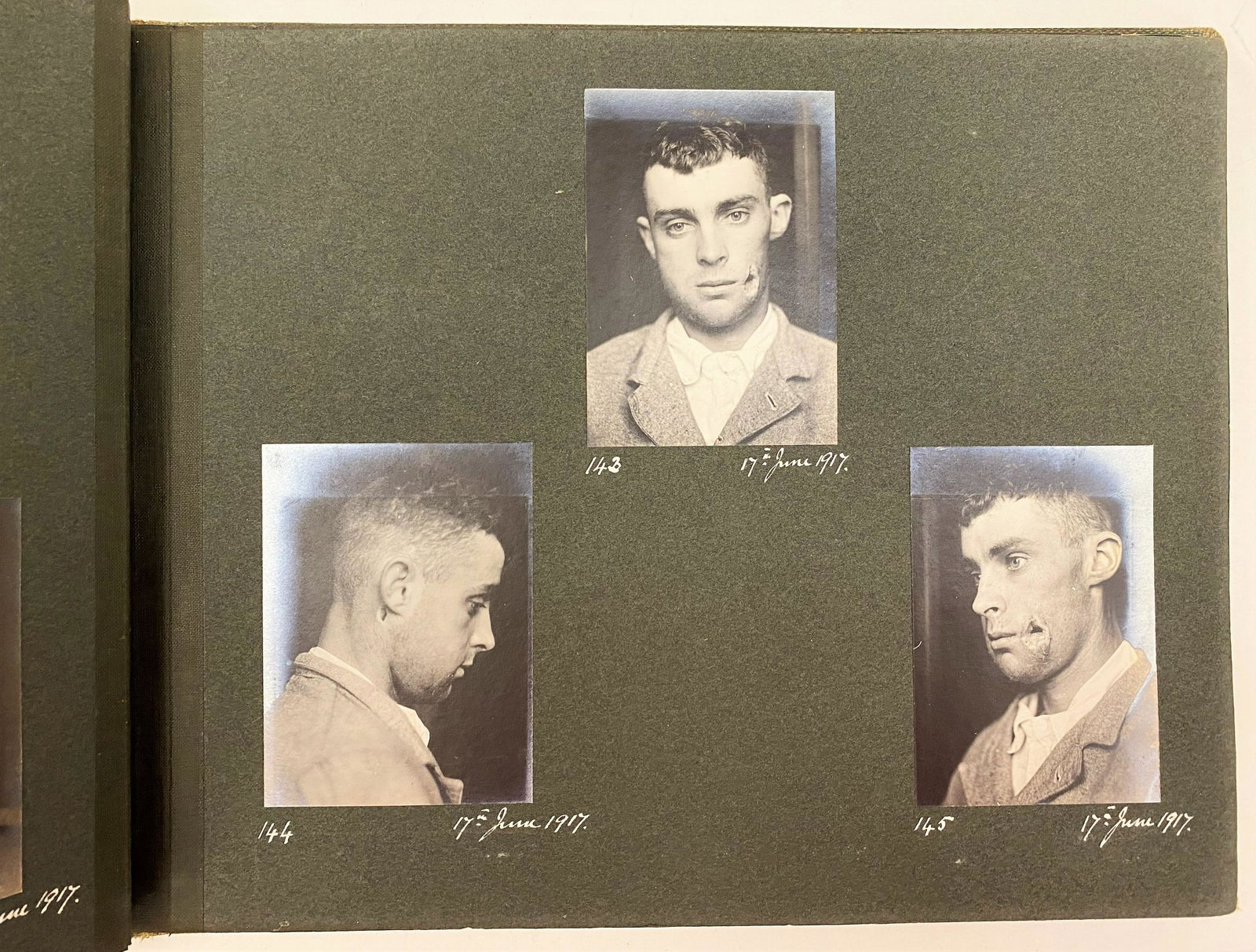 World War I, A Photograph Album Of Soldiers' Facial Injuries, Shown In ...