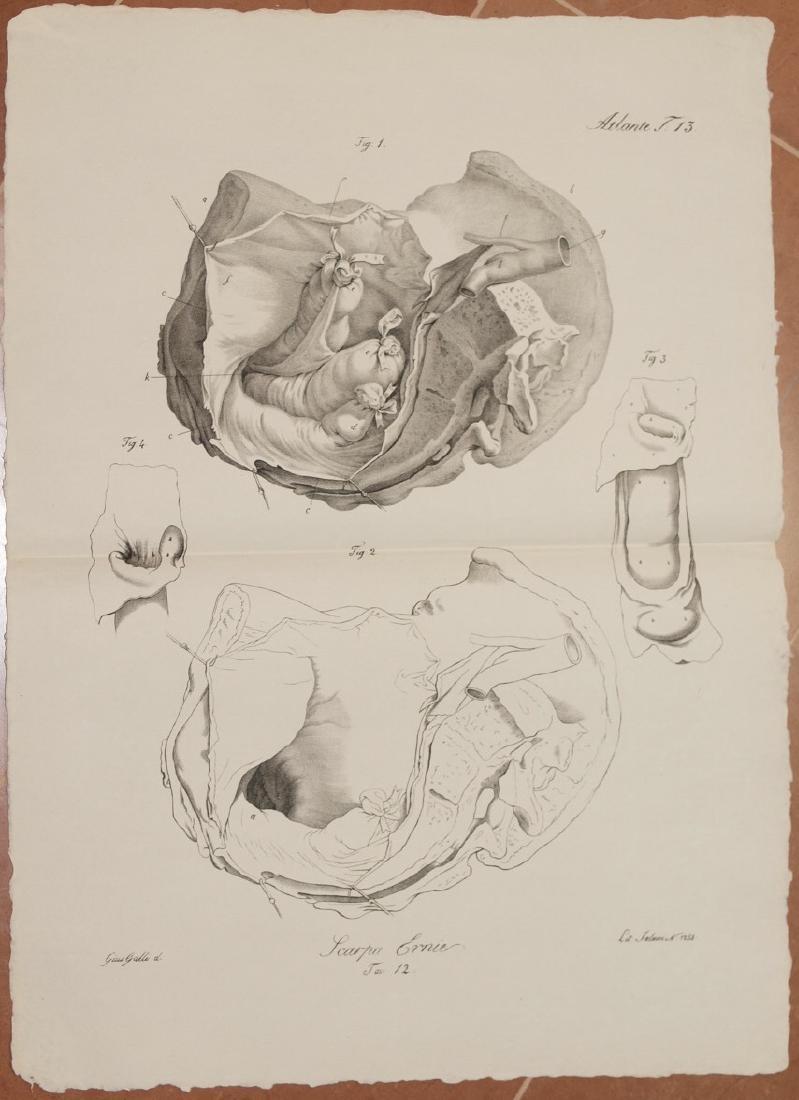 Antonio Scarpa Medicine Lithograph Hernia 1839