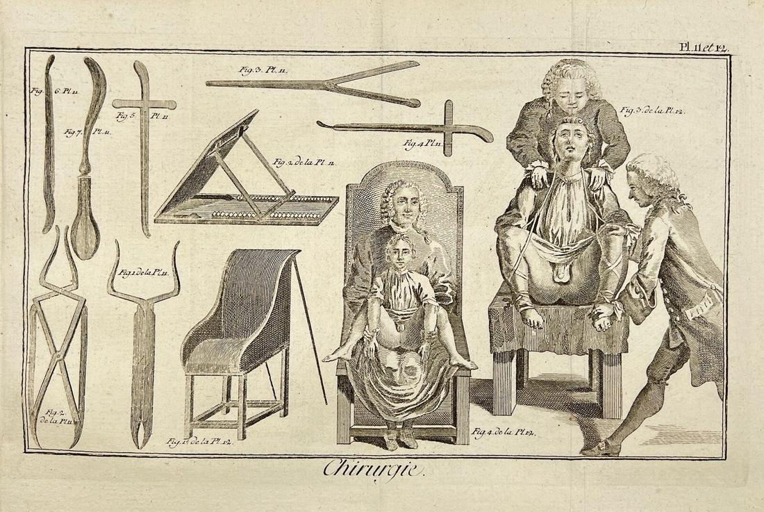 Buy Antique Print - Anatomy - Surgery - Surgical Instruments - Bladder ...