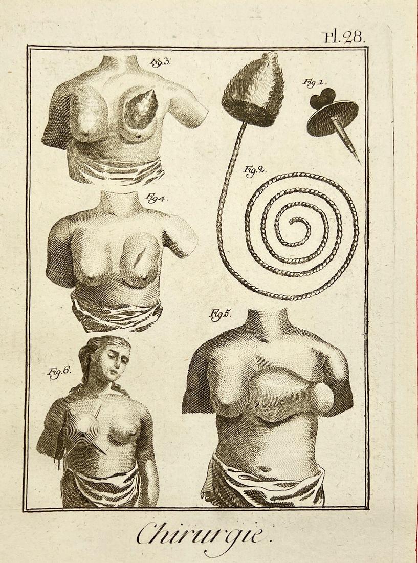 Antique Print Surgery Cruel And Imperfect Breast Amputation
