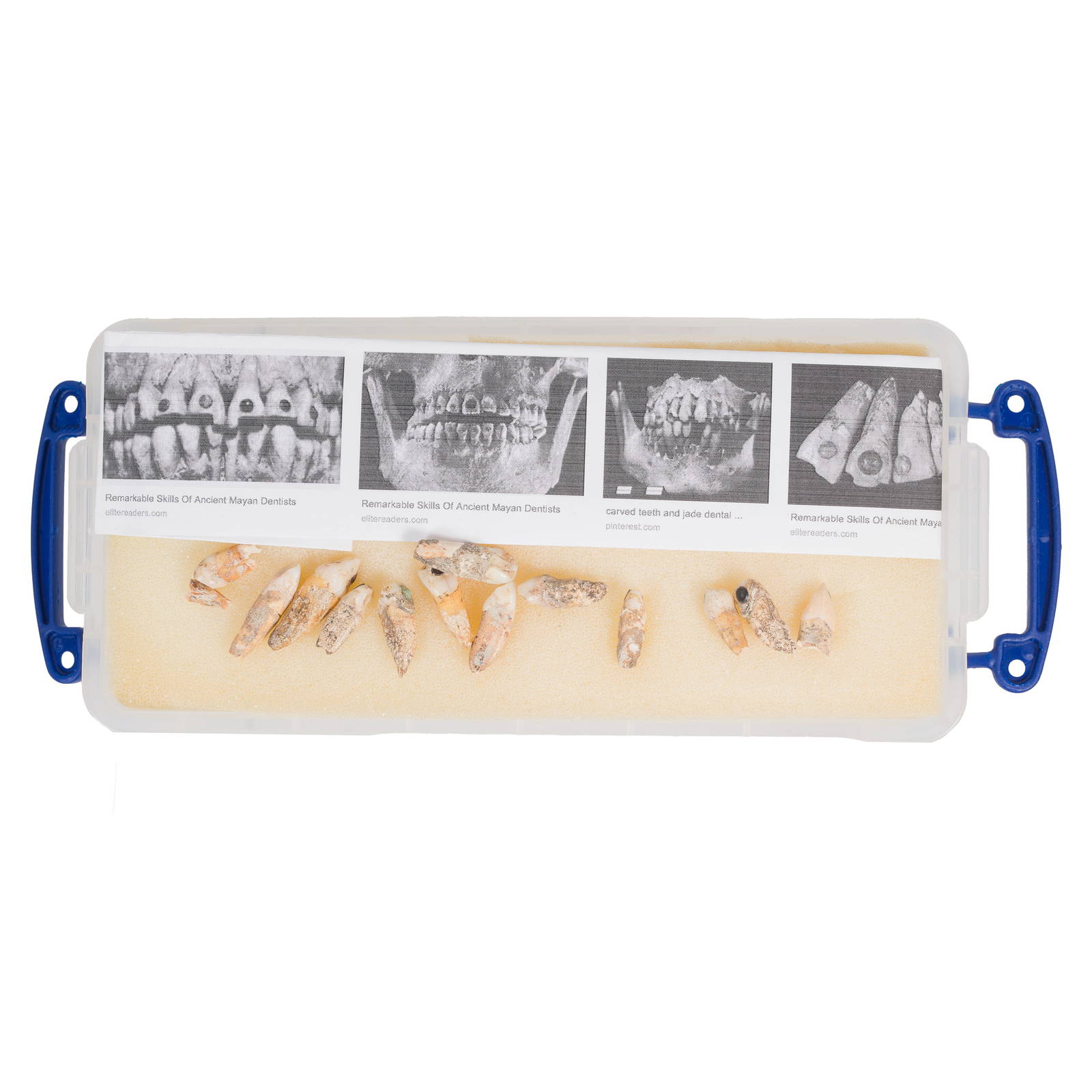 Group Of Mayan Jeweled Teeth Auction