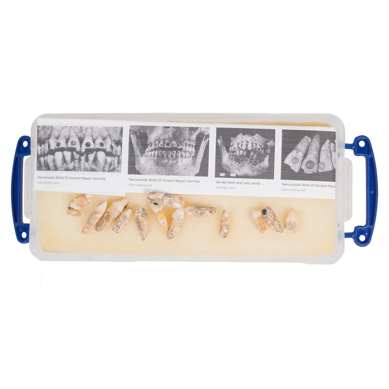 Group Of Mayan Jeweled Teeth Auction