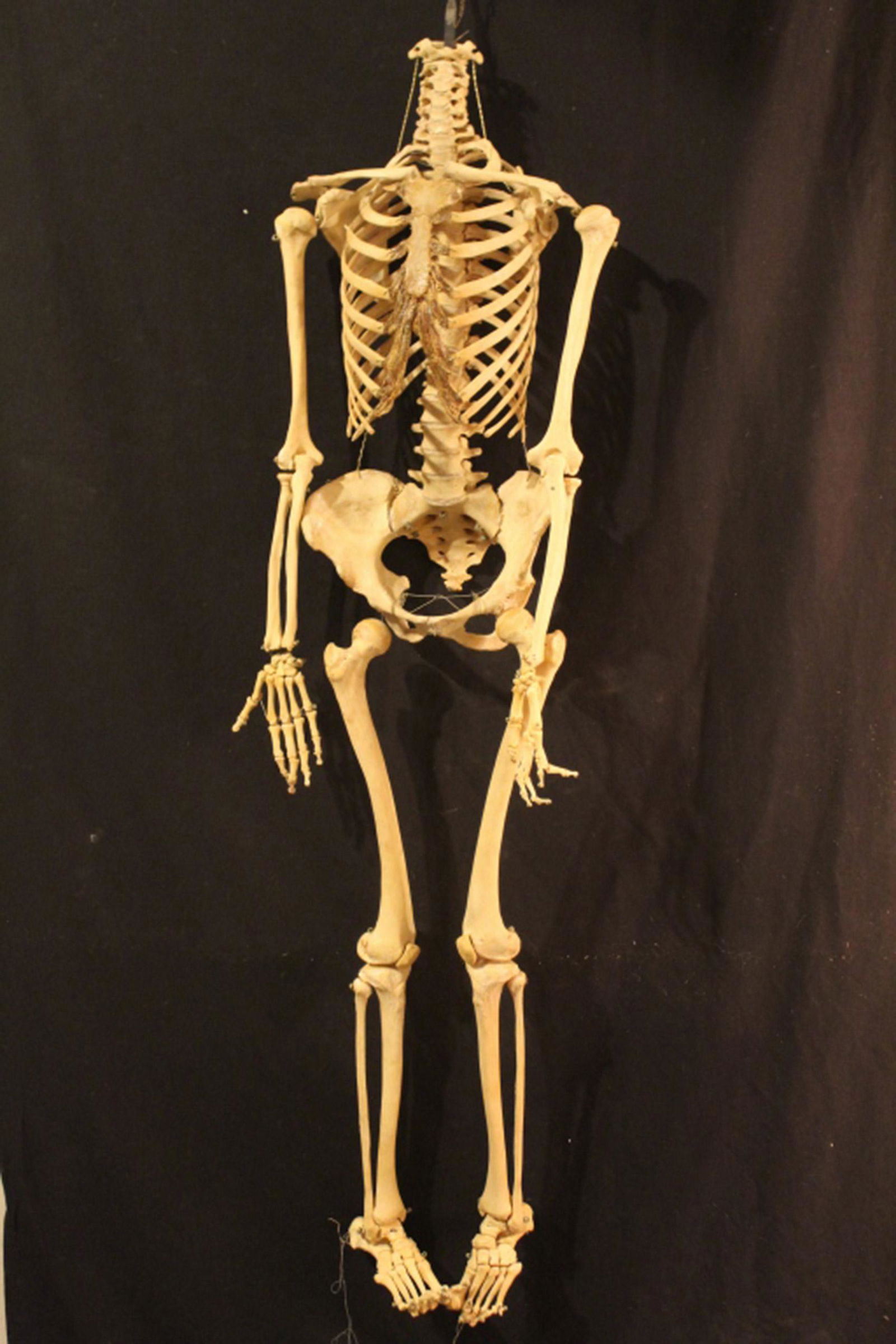 Antique Articulated Human Skeleton Without Skull - Jun 14, 2020 ...