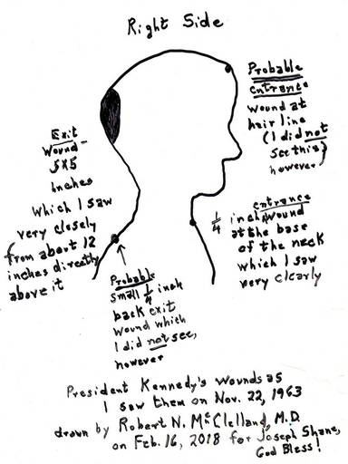 Jfk: Dr Robert Mcclelland Autopsy Sketch