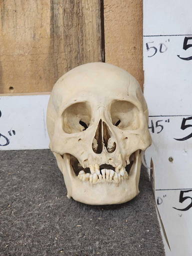 Authentic Human Skull Medical Teaching Specimen