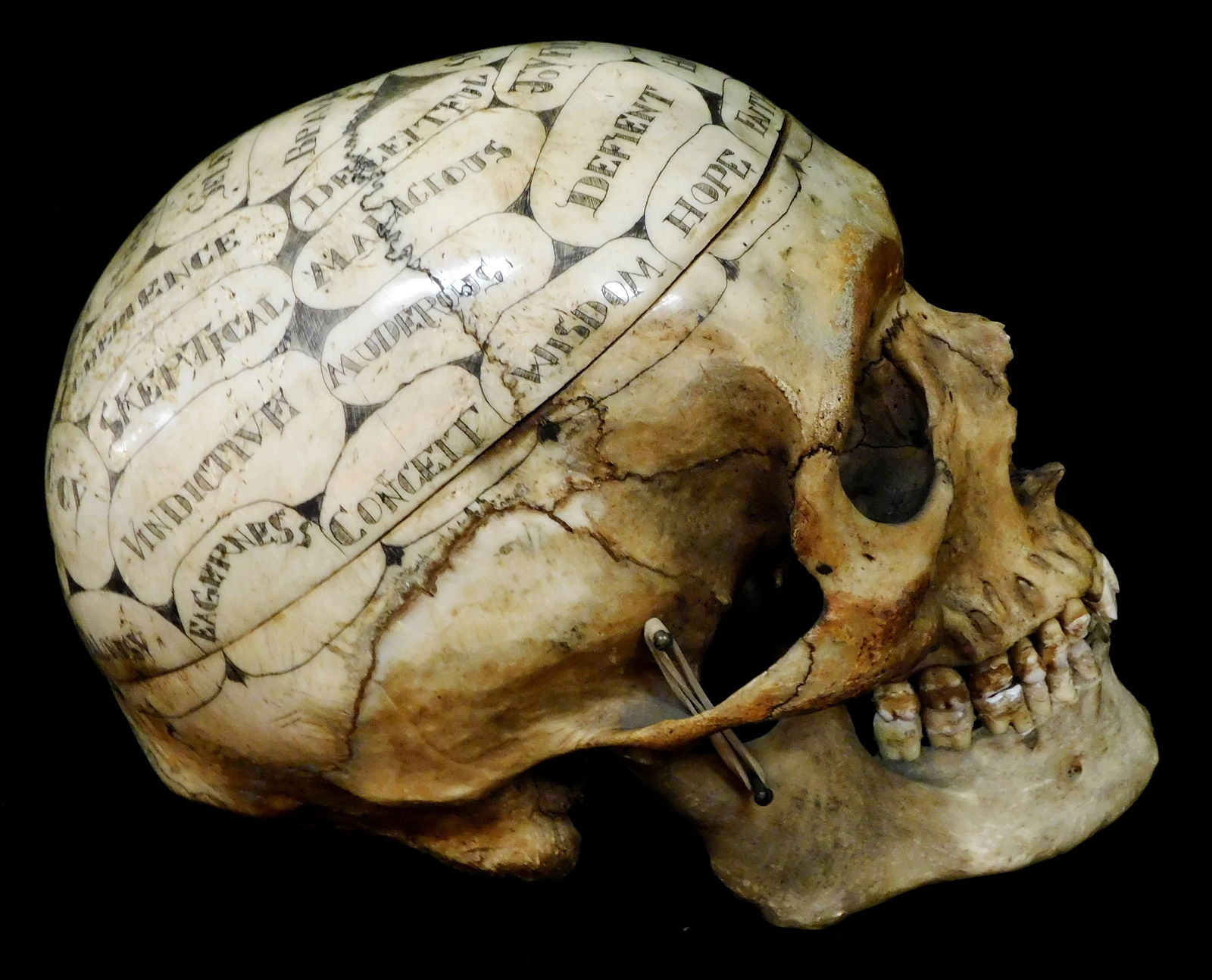 Presentation Phrenology Skull, C. 1871, Human Skull With Scrimshaw To ...