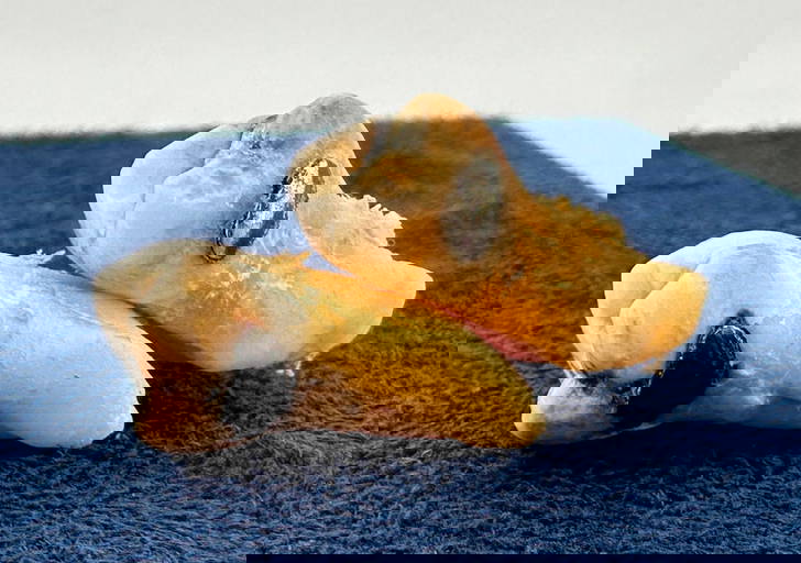 Human Teeth With Silver Amalgam Fillings