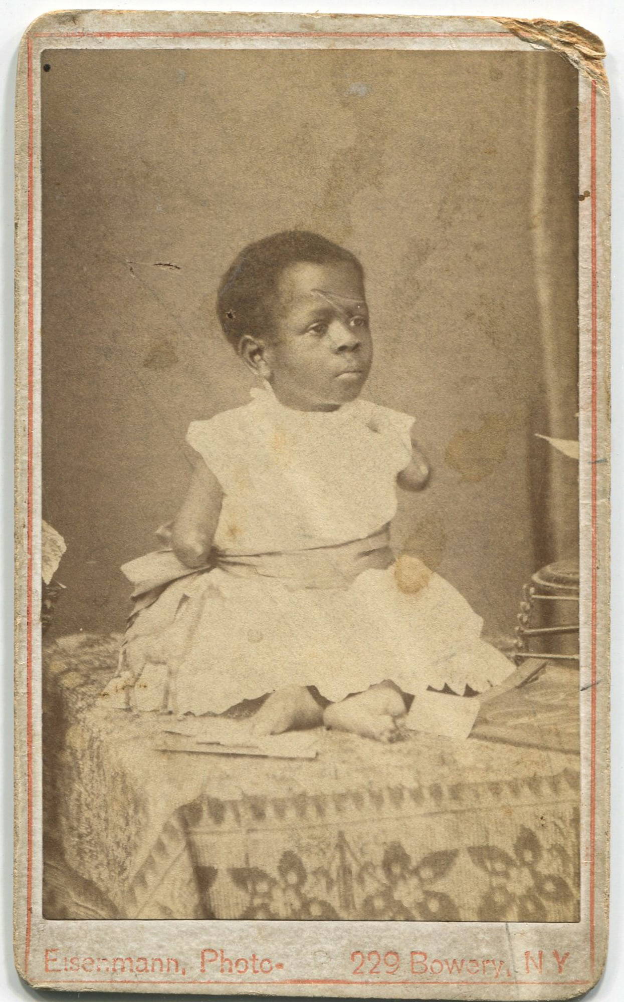 Cdv Of Barney Nelson, Armless African American Child By Eisenmann Auction