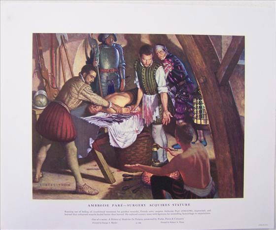 Ambroise Pare' Surgery Acquires Stature