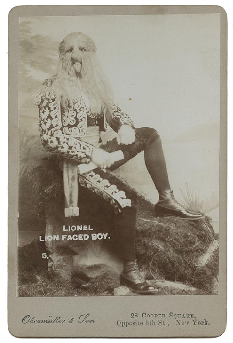 Lionel the Lion-Faced Man Cabinet Photo.