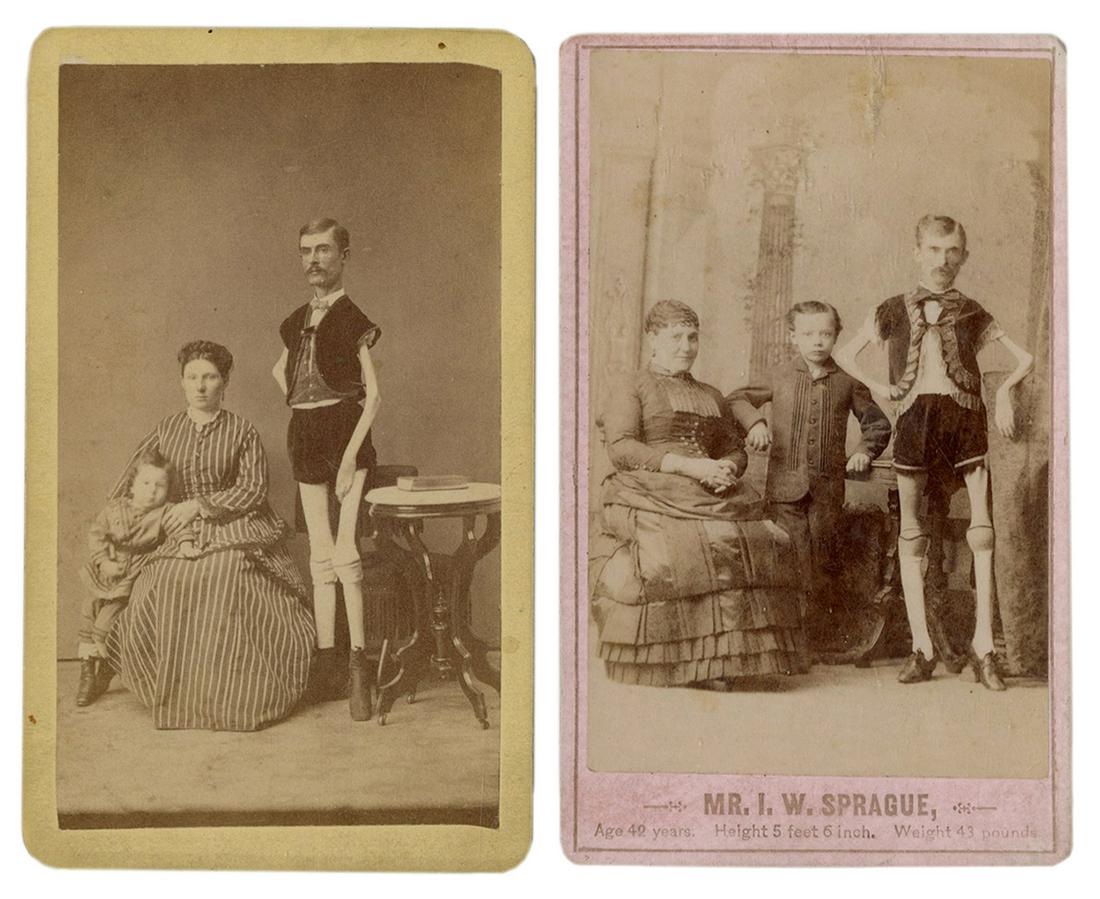 Pair of Isaac Sprague “The Living Skeleton” CDVs. - Nov 16, 2019 ...