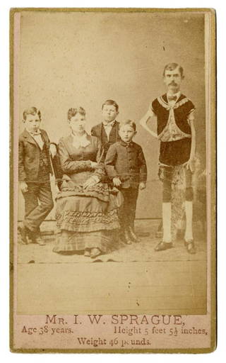 Isaac Sprague “living Skeleton” Cdv. 19th Century.