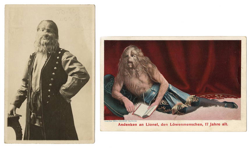 Lionel The Lion Faced Man / Jo Jo The Dog Faced Boy