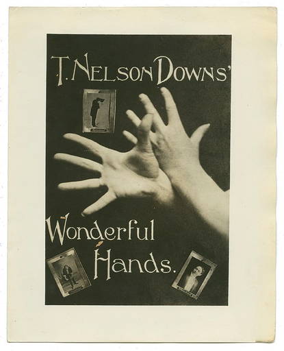 Picture Of T. Nelson Downs’ Wonderful Hands.